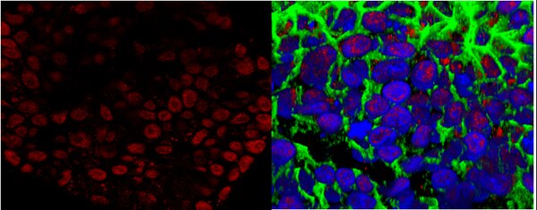 Anti-Sox2 Antibody | AB5603